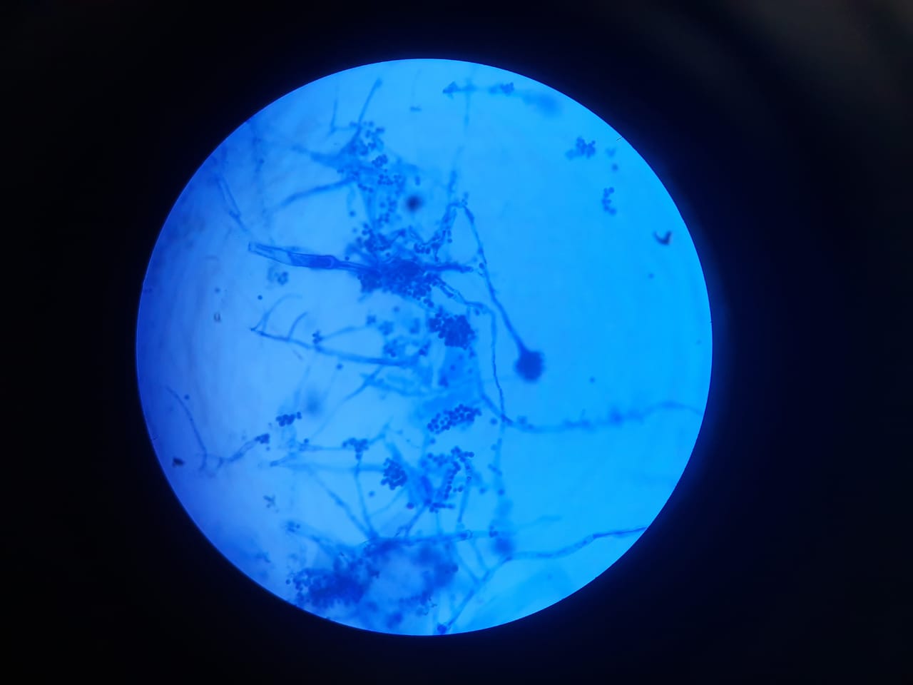 Slide Culture Technique for Fungi- Introduction, Requirement