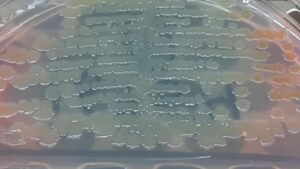 Citrobacter werkmanii-Introduction, Morphology, Pathogenicity, Lab