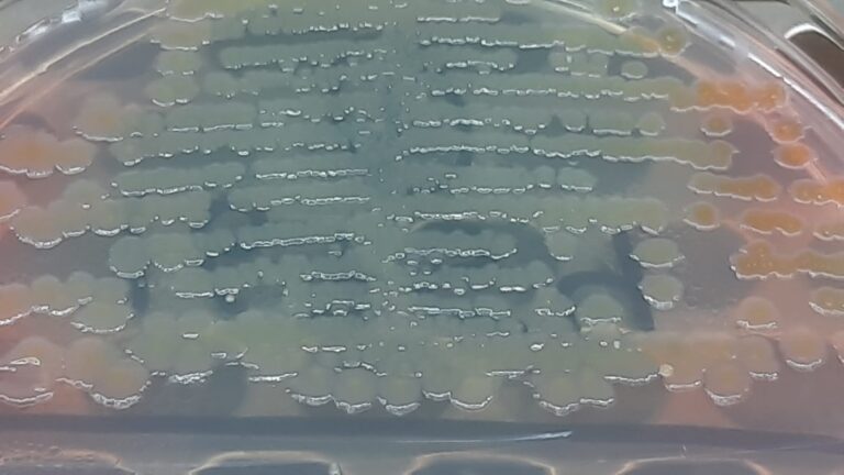 Citrobacter werkmanii-Introduction, Morphology, Pathogenicity, Lab