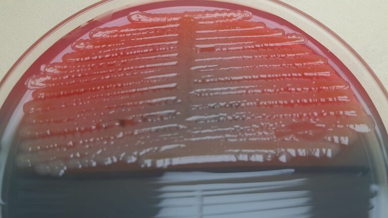 Pantoea agglomerans-Introduction, Morphology, Pathogenicity, Lab