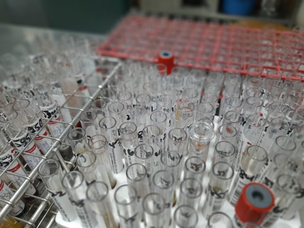 sgot (ast normal range) Archives - Medical Notes