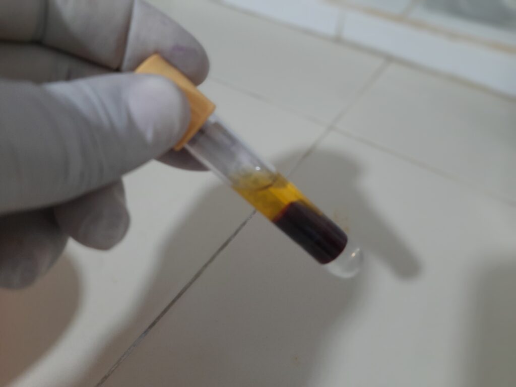 Ldl Cholesterol Range By Age Archives Medical Notes