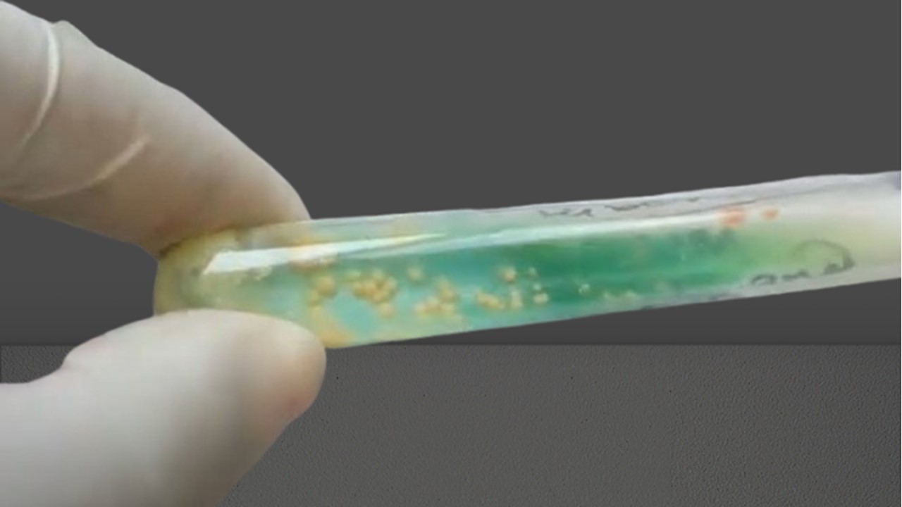 Top 10 Bacterial Pathogens: List with short Descriptions