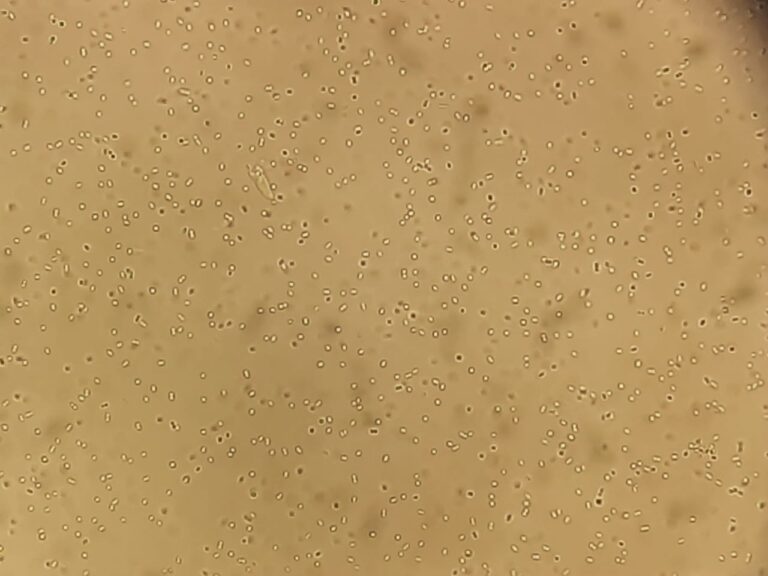 MDR ESKAPE-Introduction, Group of Pathogens, Clinical Importan
