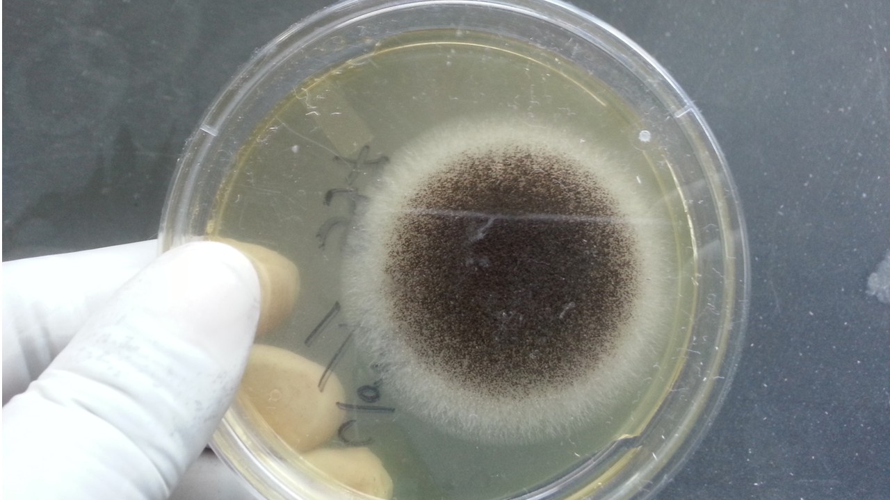 Fungal Culture-Introduction,Common Culture Media, Application
