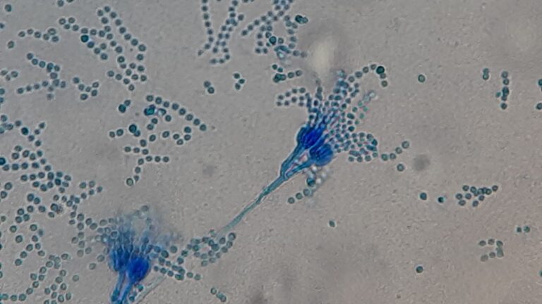 Fungal Identification-Introduction, Conventional Method, and MALD