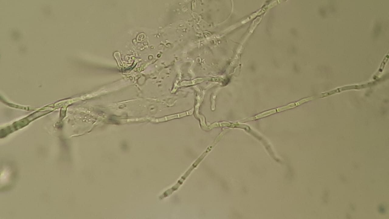 Fungal Identification-Introduction, Conventional Method, and MALD