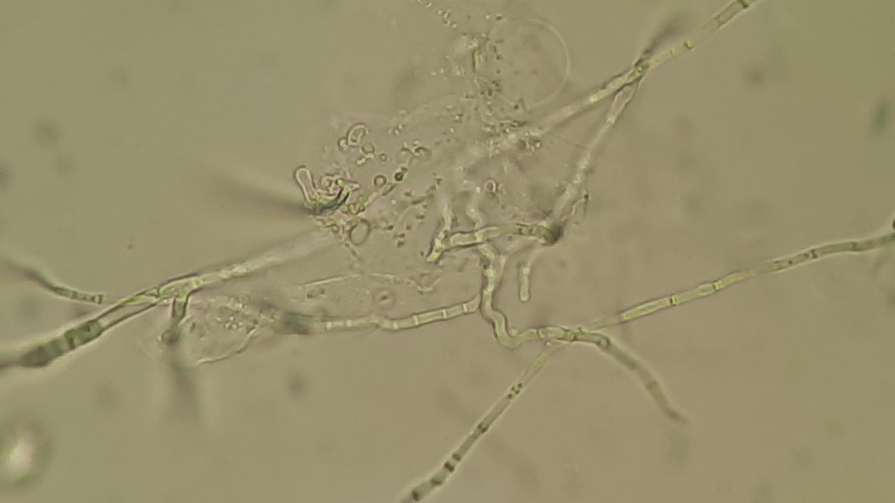 Fungal Identification-Introduction, Conventional Method, and MALD