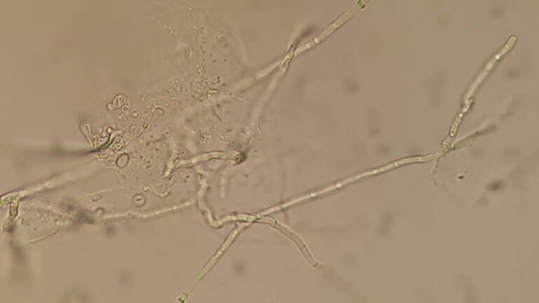 Fungal Identification-Introduction, Conventional Method, and MALD