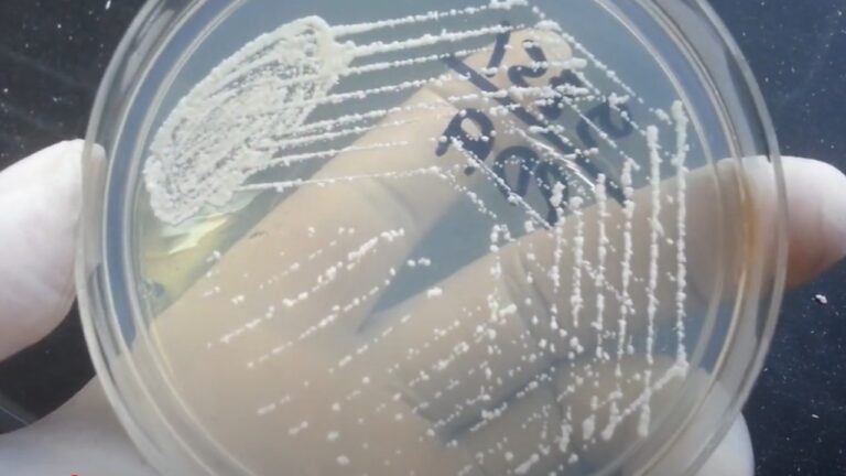 Fungal Culture-Introduction,Common Culture Media, Application