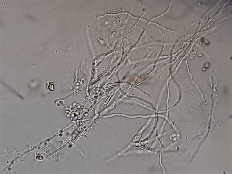 Candida albicans- Introduction, Morphology, Pathogenicity, Lab