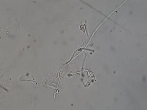 Candida albicans- Introduction, Morphology, Pathogenicity, Lab