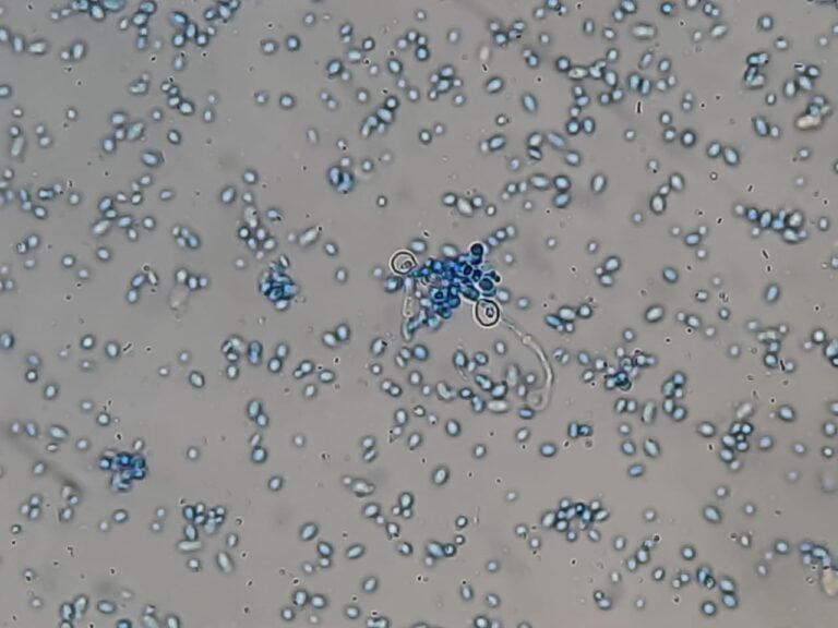 Chlamydospores: Nature’s Survival Spores in Fungi and Alga
