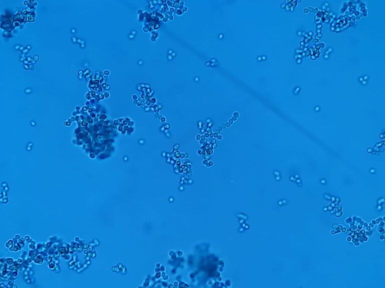 Aspergillus and penicillium conidia differences: Introduction