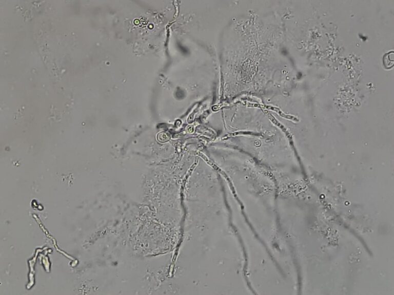 Candida albicans- Introduction, Morphology, Pathogenicity, Lab