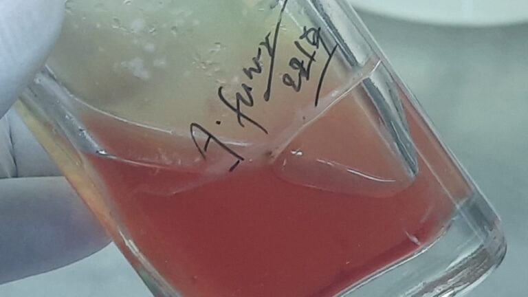 Biphasic Medium in Microbiology: Introduction, Application,