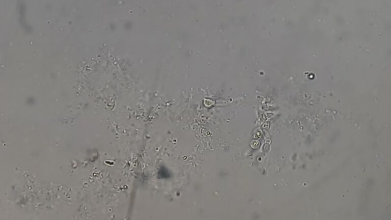 Funguria-Introduction, Common fungi, Clinical Feature, Lab Diag