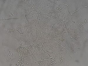 Funguria-Introduction, Common fungi, Clinical Feature, Lab Diag