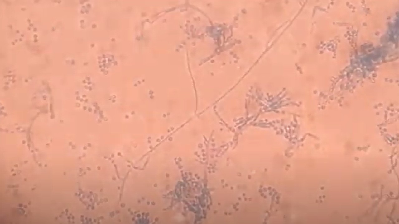 Penicillium Vs Paecilomyces Introduction Detailed Comparison