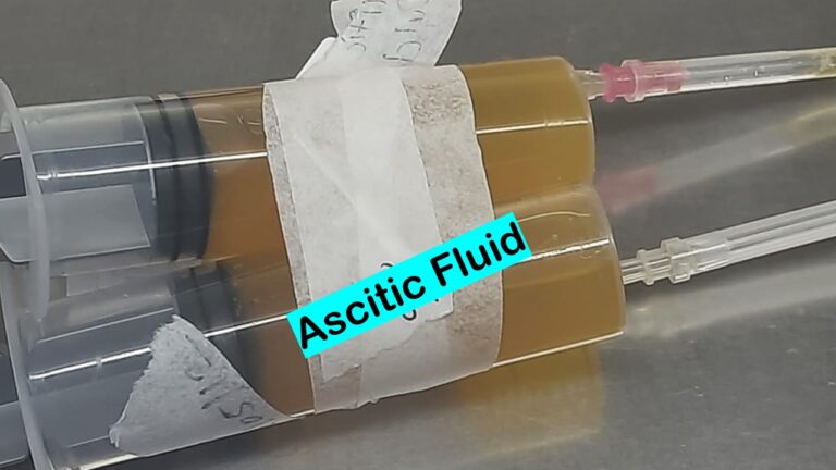Ascitic Fluid Microscopy: Introduction, Principle, Test Requirements