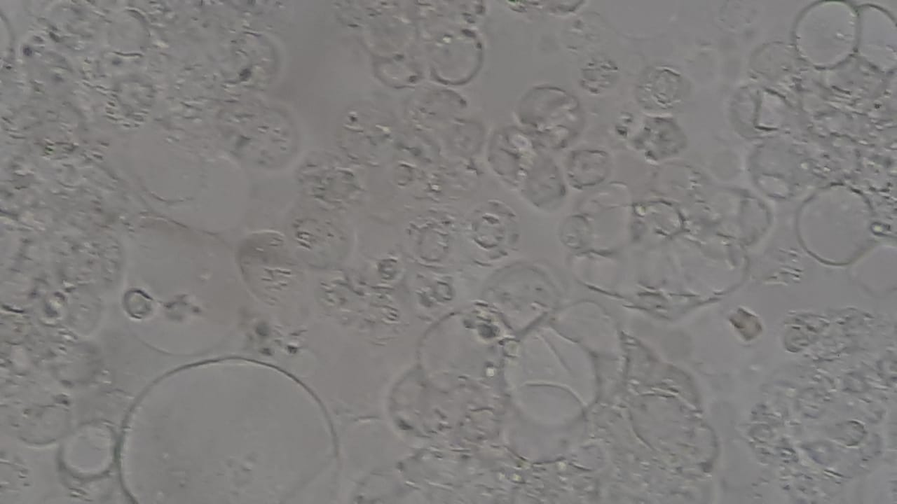 Ascitic Fluid Microscopy: Introduction, Principle, Test Requirements