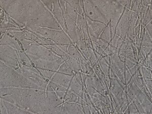 Comparative Microscopy of Common Clinical Fungi-Introduction