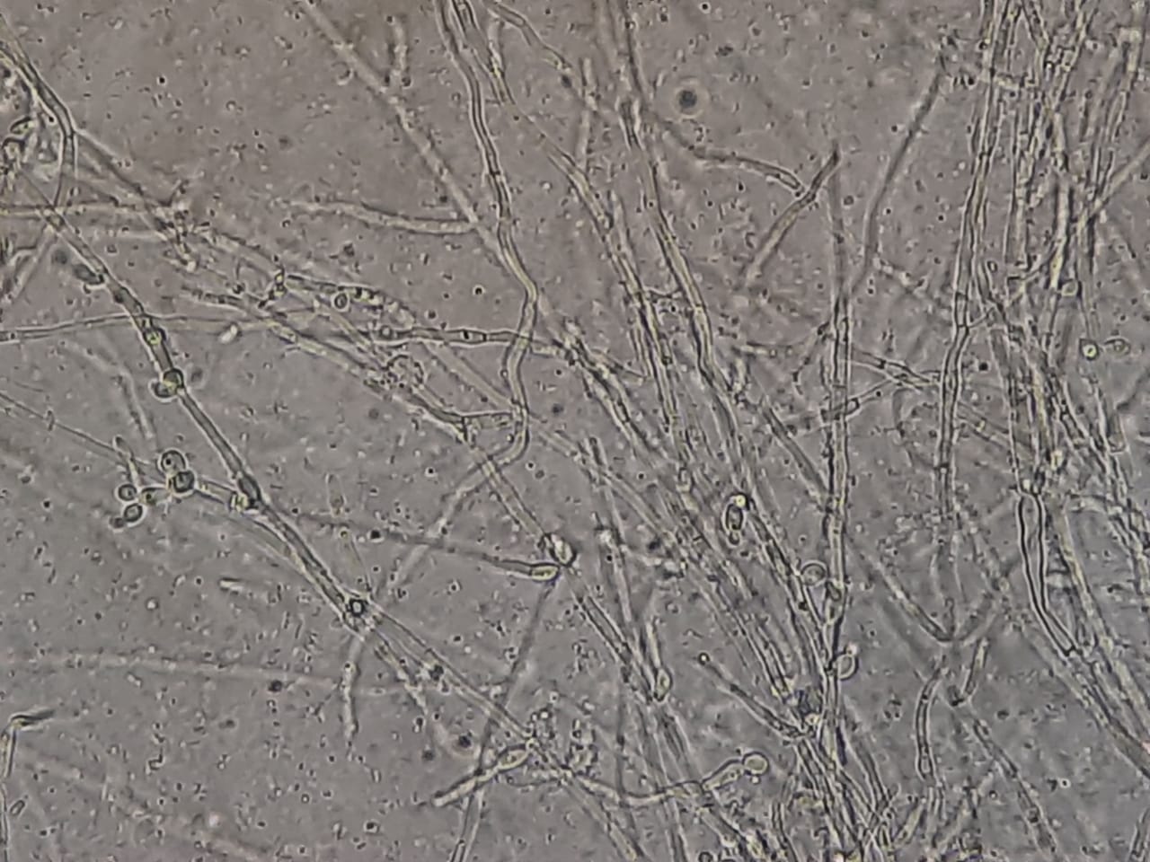 Comparative Microscopy of Common Clinical Fungi-Introduction