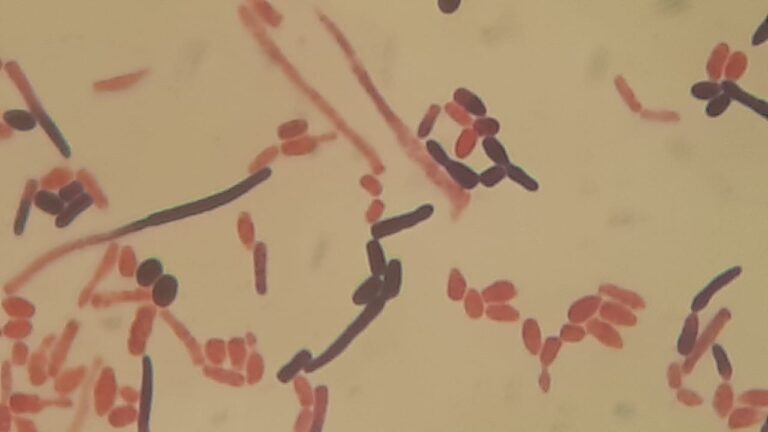 Blood Culture–Positive Yeasts: Introduction, Common molds