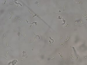 Direct Microscopy-KOH Smear: Introduction, Uses, and Keynotes