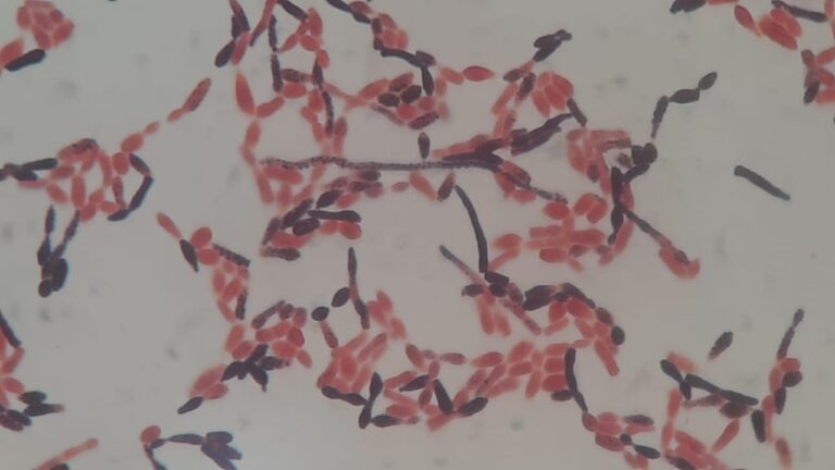 Blood Culture–Positive Yeasts: Introduction, Common molds