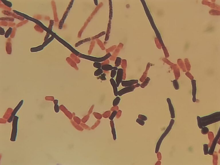 Blood Culture–Positive Yeasts: Introduction, Common molds
