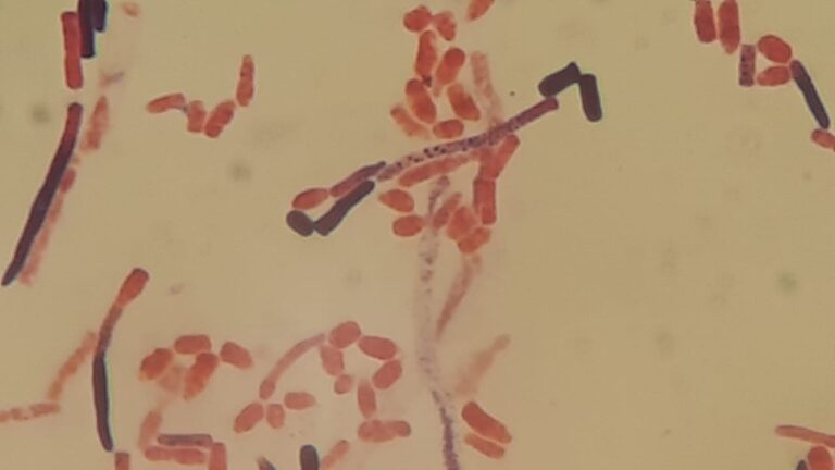 Blood Culture–Positive Yeasts: Introduction, Common molds