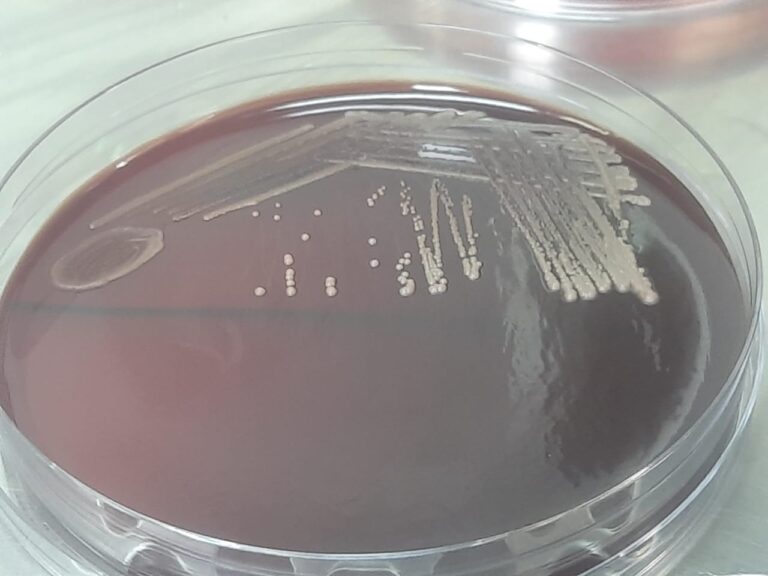 Blood Culture–Positive Yeasts: Introduction, Common molds