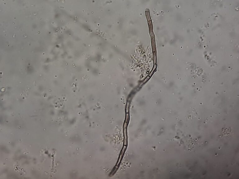 Direct Microscopy-KOH Smear: Introduction, Uses, and Keynotes
