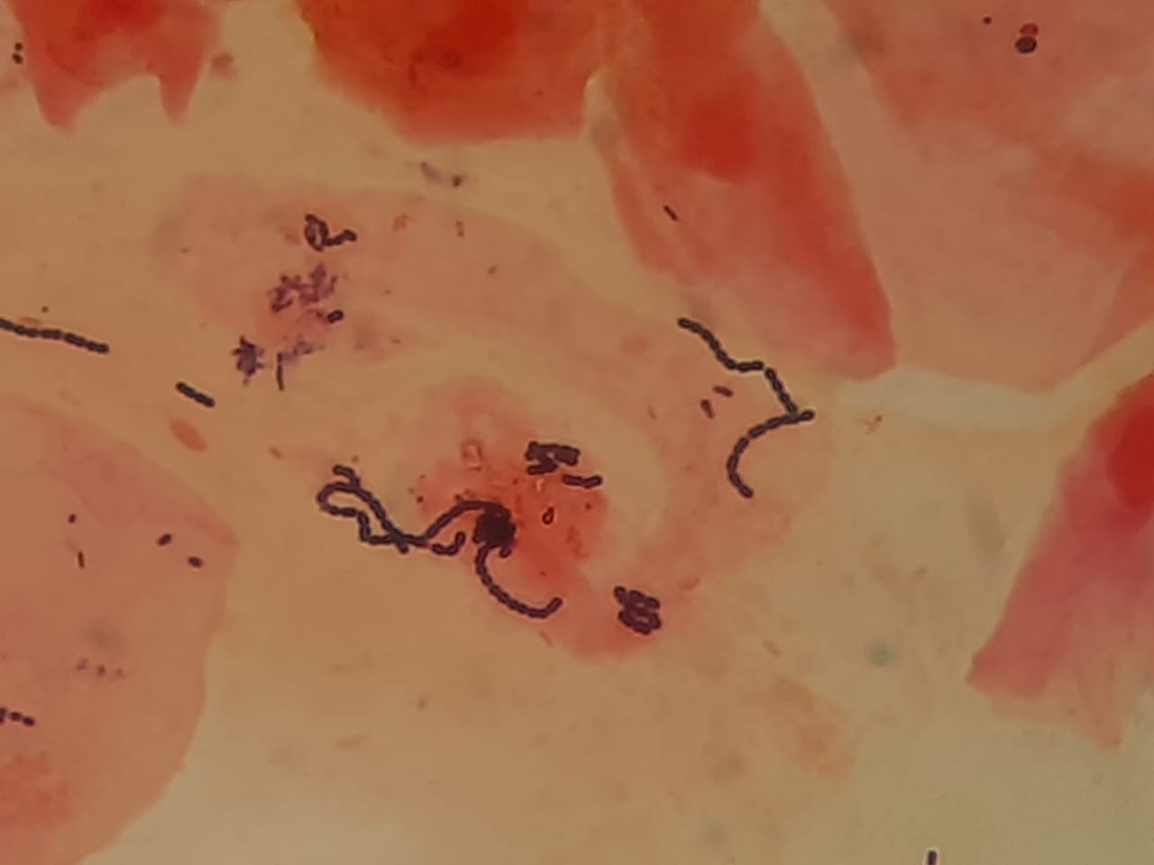 Throat Swab Gram stain: Introduction, Report-Interpretation