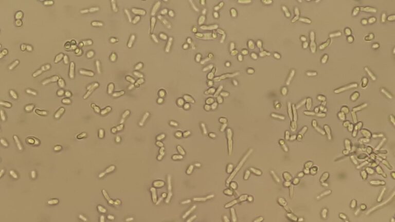 Blood Culture–Positive Yeasts: Introduction, Common molds