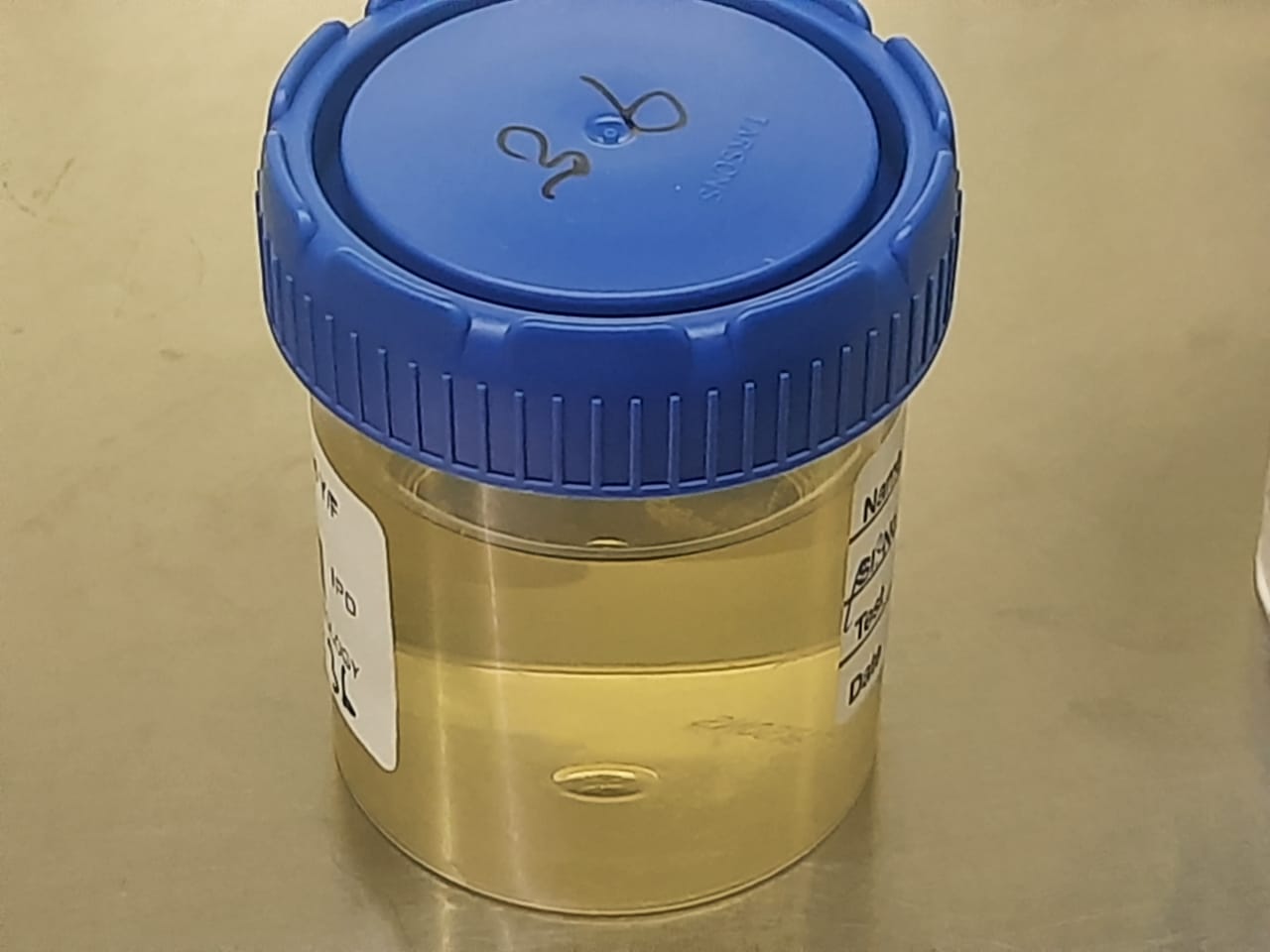 Fungal Culture of Clinical Samples: Introduction, Principle, Clinical