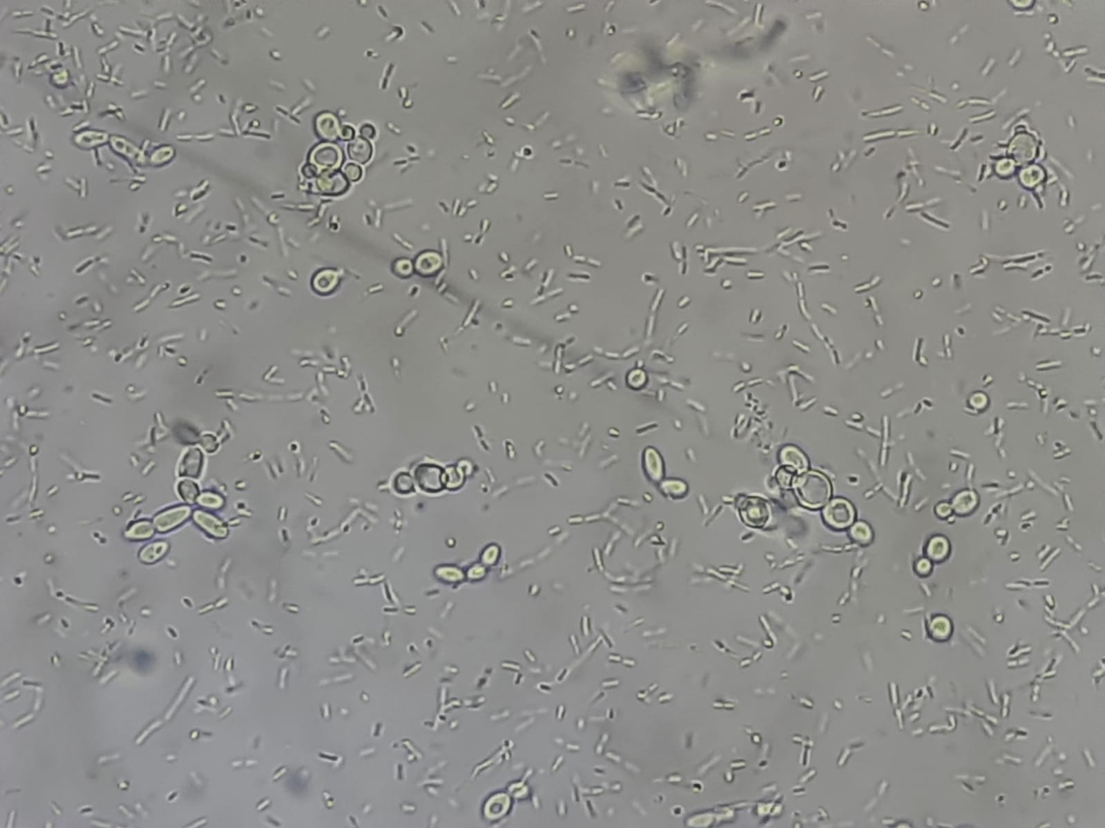 Direct Microscopy-KOH Smear: Introduction, Uses, and Keynotes
