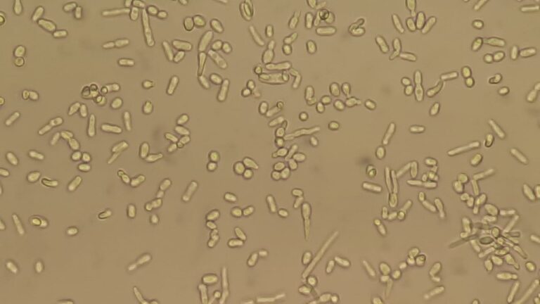 Blood Culture–Positive Yeasts: Introduction, Common molds