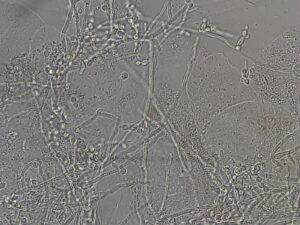 Direct Microscopy-KOH Smear: Introduction, Uses, and Keynotes