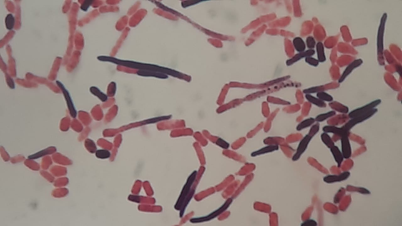 Blood Culture–Positive Yeasts: Introduction, Common molds