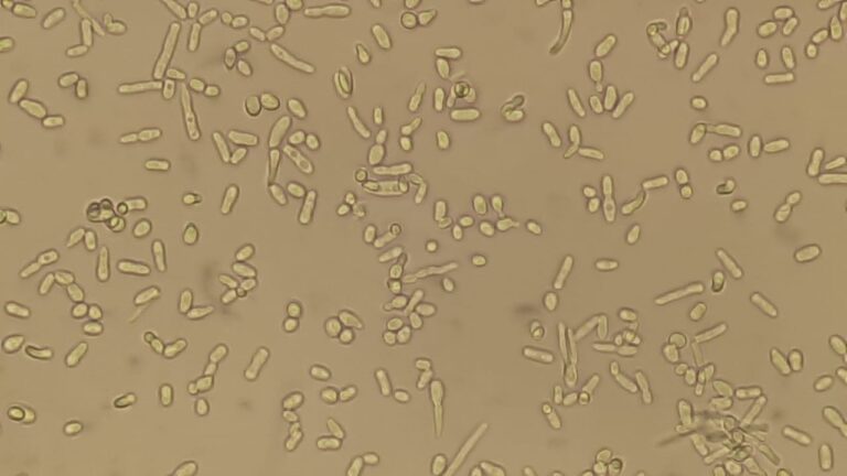 Blood Culture–Positive Yeasts: Introduction, Common molds