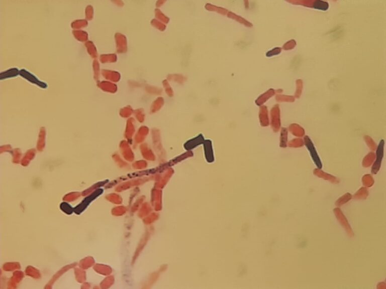Blood Culture–Positive Yeasts: Introduction, Common molds