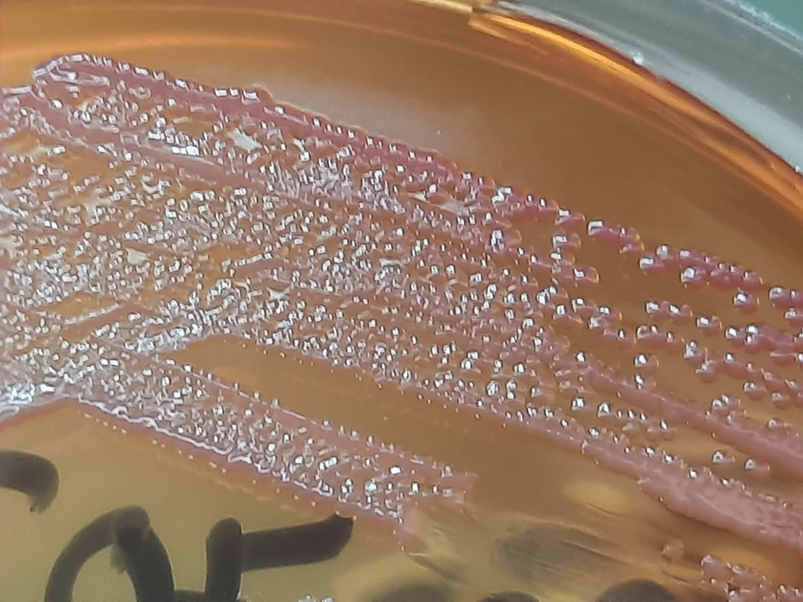 Bronchoalveolar lavage (BAL) Gram stain: Introduction, Report
