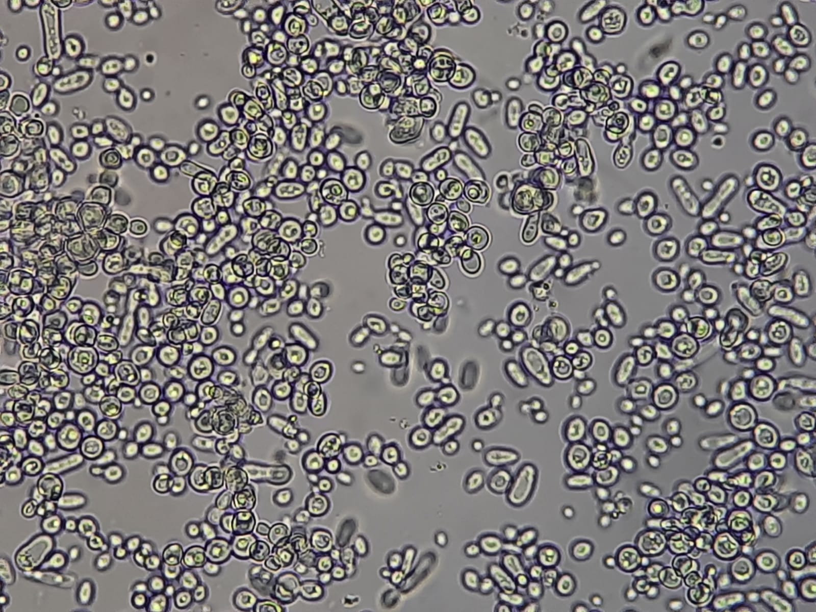 Fungal Elements in KOH Mount of Bile Microscopy-Introduction