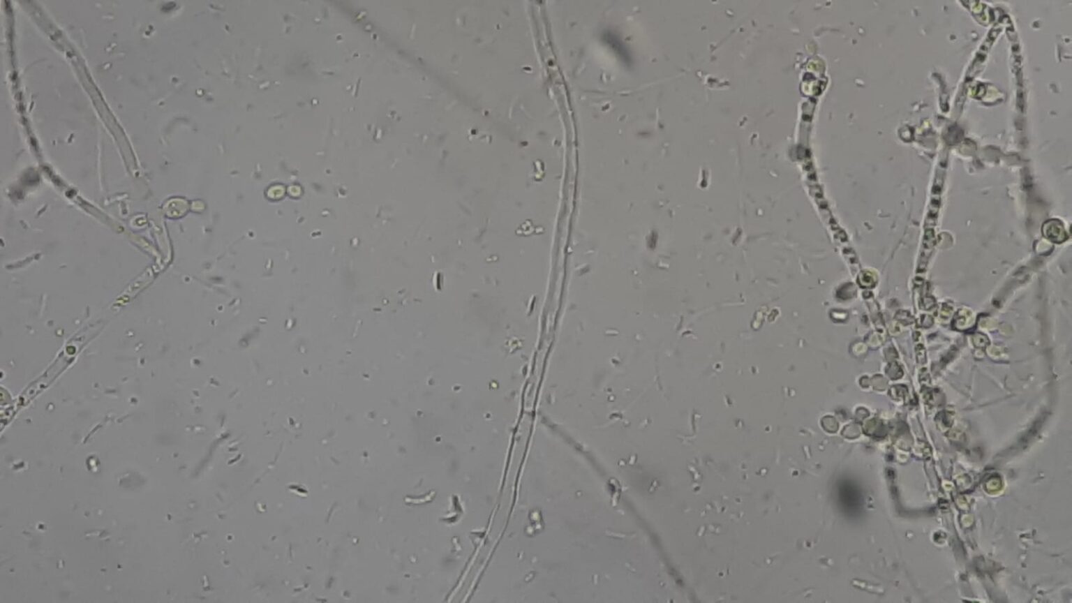 Fungal Elements in KOH Mount of Bile Microscopy-Introduction