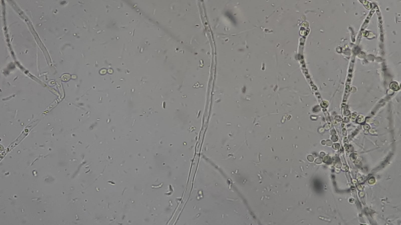 Fungal Elements in KOH Mount of Bile Microscopy-Introduction