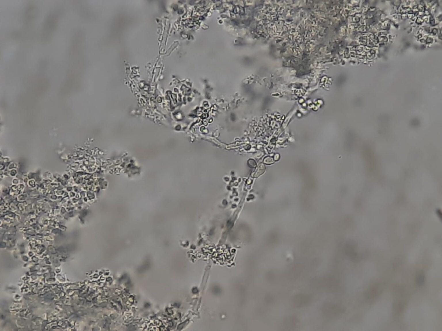 Fungal Elements in KOH Mount of Urine Microscopy: Introduction