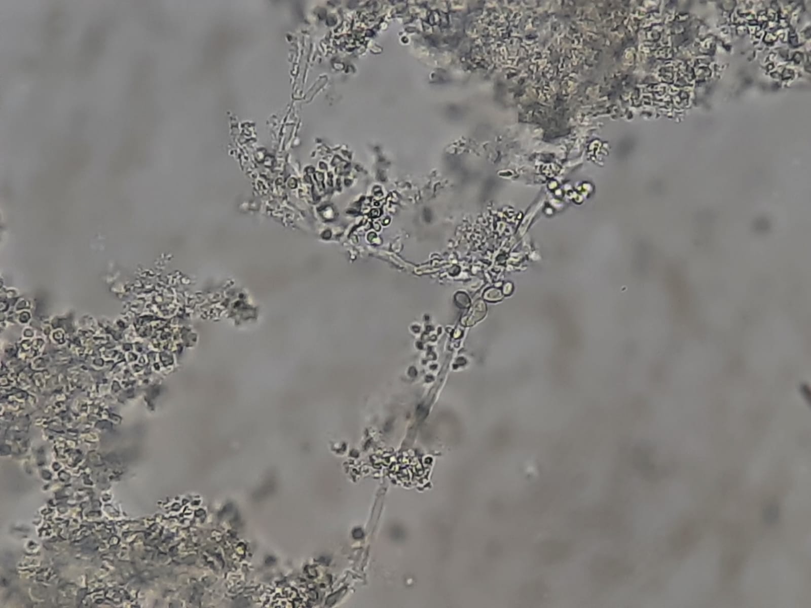 Fungal Elements in KOH Mount of Urine Microscopy: Introduction