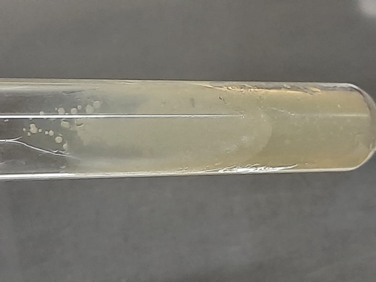 Isolation and Preliminary Identification of Bacterial and Yeast